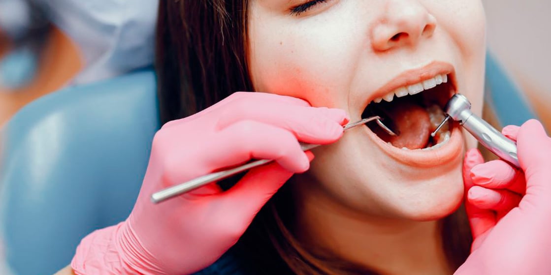 ¿Qué es la rehabilitación oral? | DentiSalud